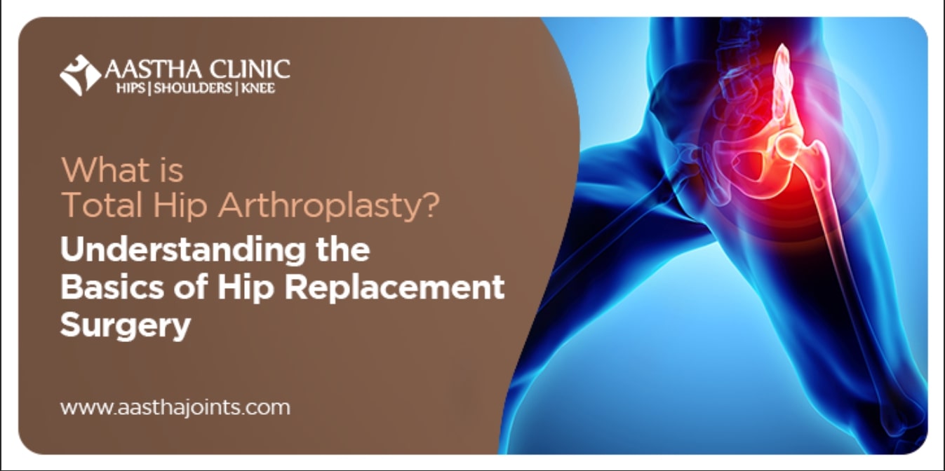 What is Total Hip Arthroplasty? Understanding the Basics of Hip ...